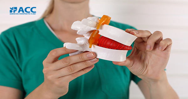 What you should know about annular disc tear? - ACC English